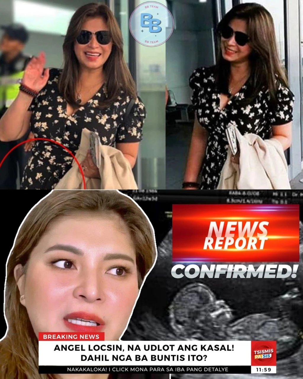 Angel Locsin BUNTIS NGA BA?! SHOCKING na Pahayag, ALAMIN DITO! - News