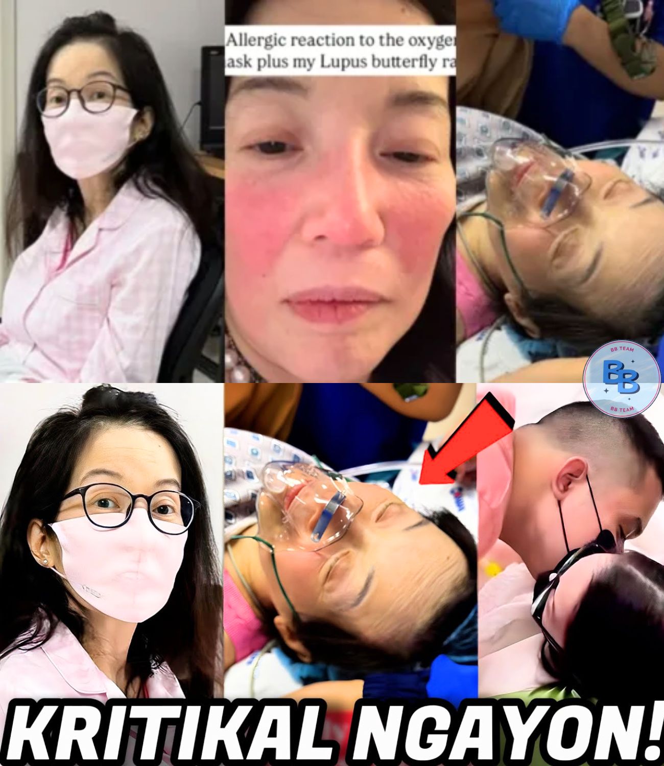 NAKAKALUHANG REBELASYON! Kris Aquino, LUMALALA ANG KALAGAYAN—Doktor, NAGBIGAY NG BABALA ...