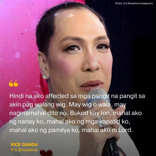 Vice Ganda Removes Wig on Live TV — Karylle Posts Touching Message That Leaves Fans Emotional - News
