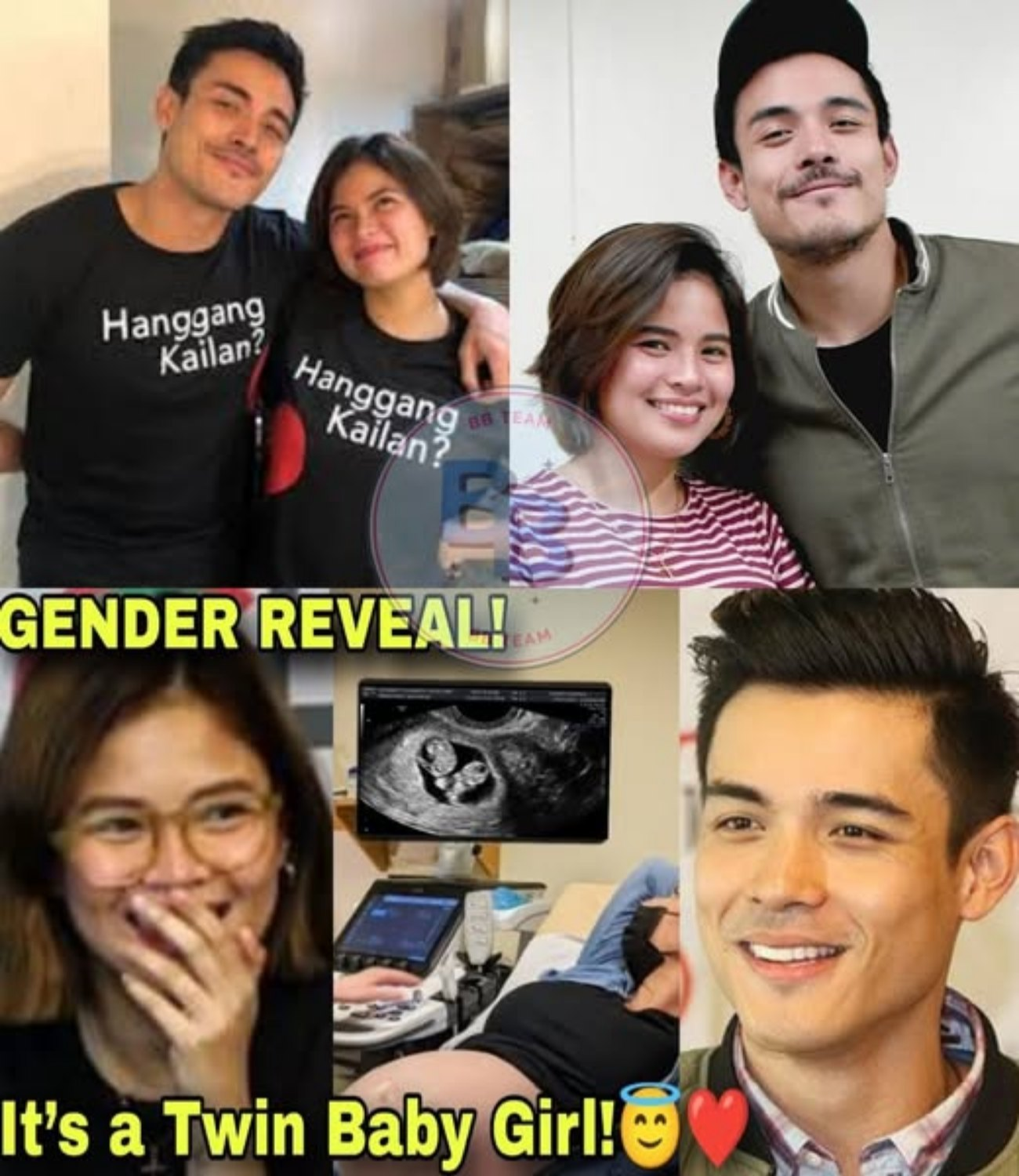 Louise Delos Reyes and Xian Lim Surprise Fans with the Revelation of a Closely Guarded Secret ...
