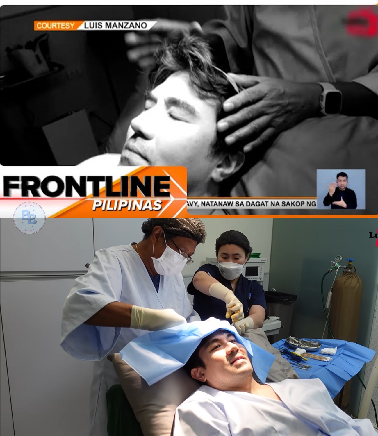 LIGLIG ANG BANSA SA BUKOL SA ULO NI LUIS MANZANO! Pero Mas Nakagugulat ang Bagong Natuklasan ng ...