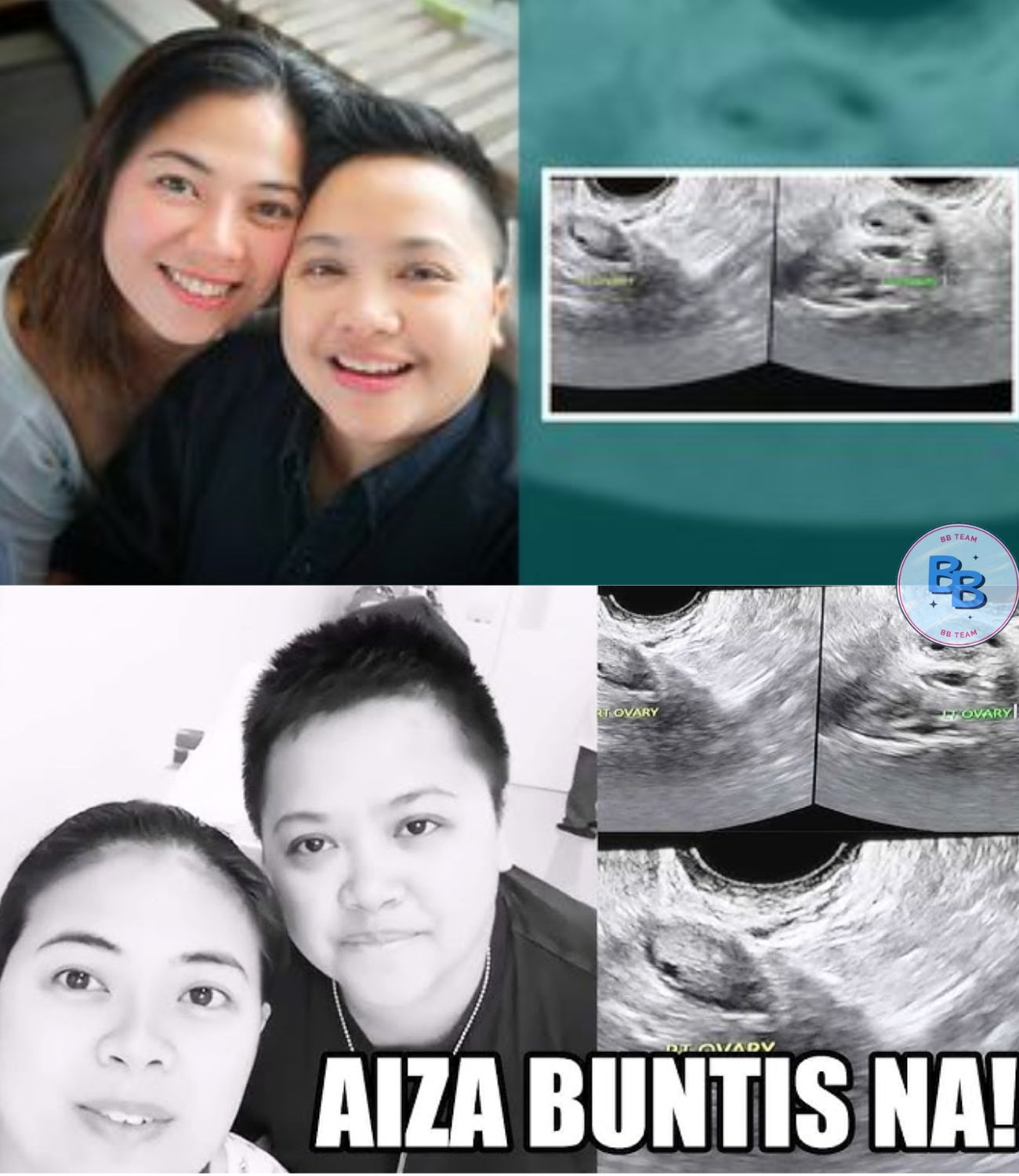 SH0CKING REVELATION! Ice Seguerra, BUMALIK at NAGPANIWALA sa Netizens na May ‘BABY BUMP’ Siya ...