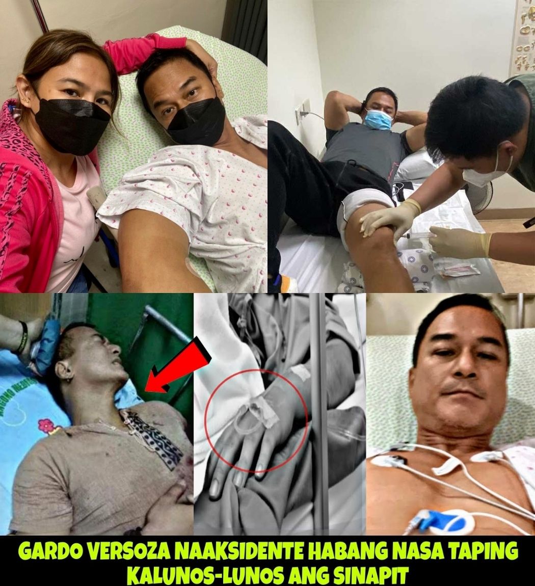GARDO VERSOZA, NAAKSIDENTE HABANG NASA TAPING—AGAW BUH4Y AT KALUNOS ...