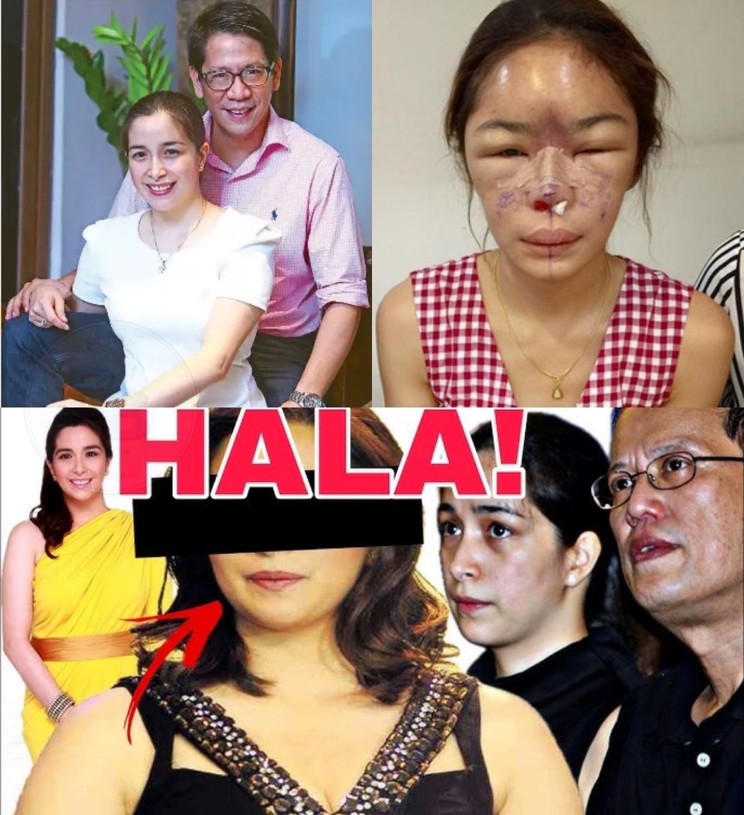 Ang Katatagan at Kadakilaan ni Shalani Soledad, Isang Kwento ng ...